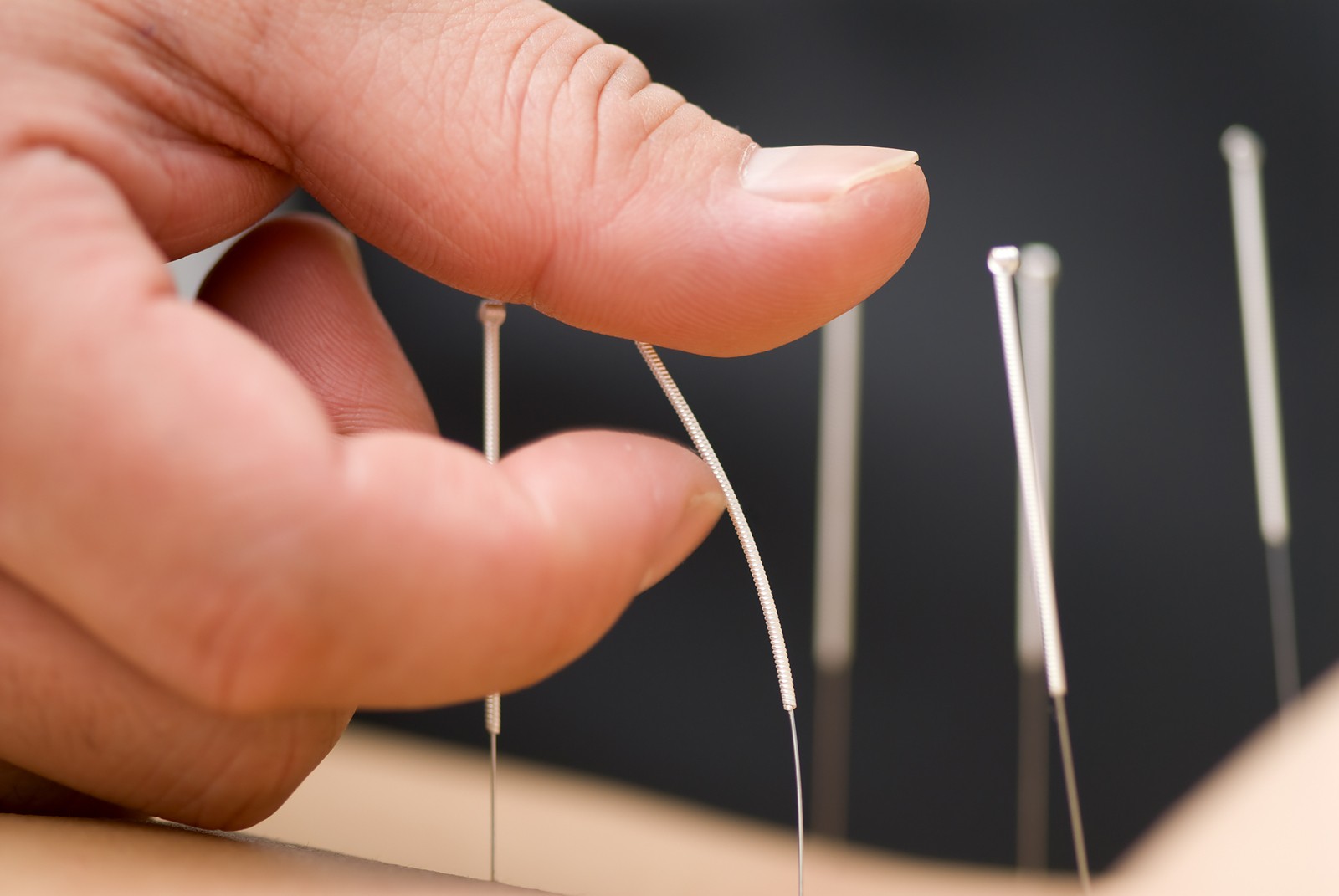 What Does Acupuncture Feel Like What Does Acupuncture Feel Like